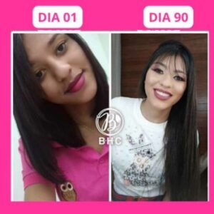 BHC Hair funciona ou não? Cuidado com esse relato! 2025