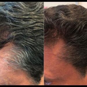 Mega Folic funciona? 3 Opiniões com Prós e Contras Cuidado!